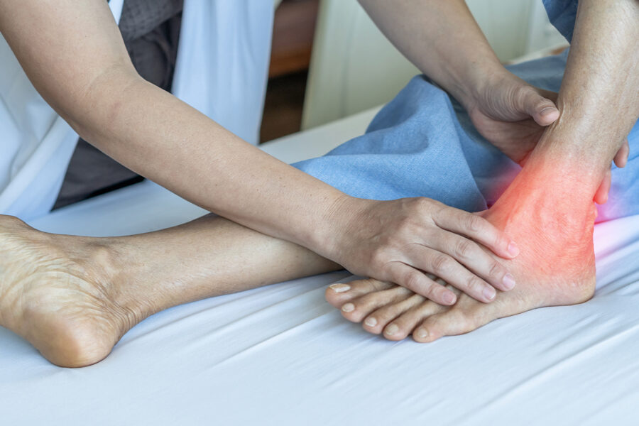Charcot-Marie-Tooth Disease in San Francisco, CA | Foot Surgery San ...